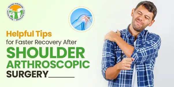 A Comprehensive Guide to Shoulder Arthroscopic Surgery Aftercare